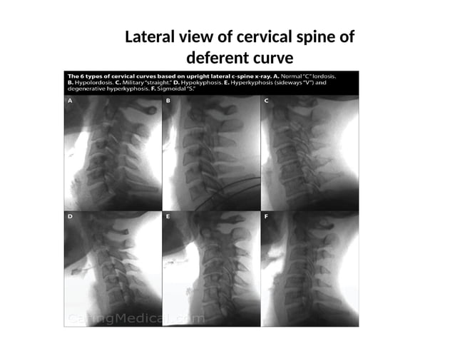 Cervical spine and architecture biomechanics | PPTX | Bone and Joint ...