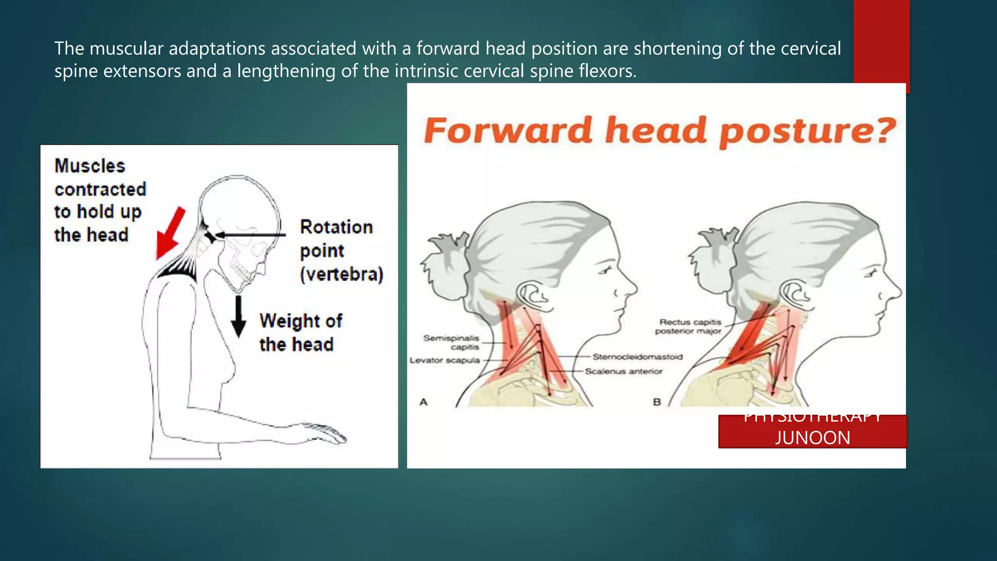 Cervical spine part 2 | PPT