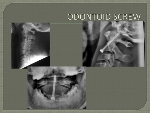 Cervical spinepathology