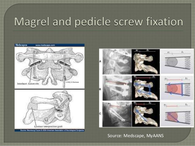 Cervical spinepathology