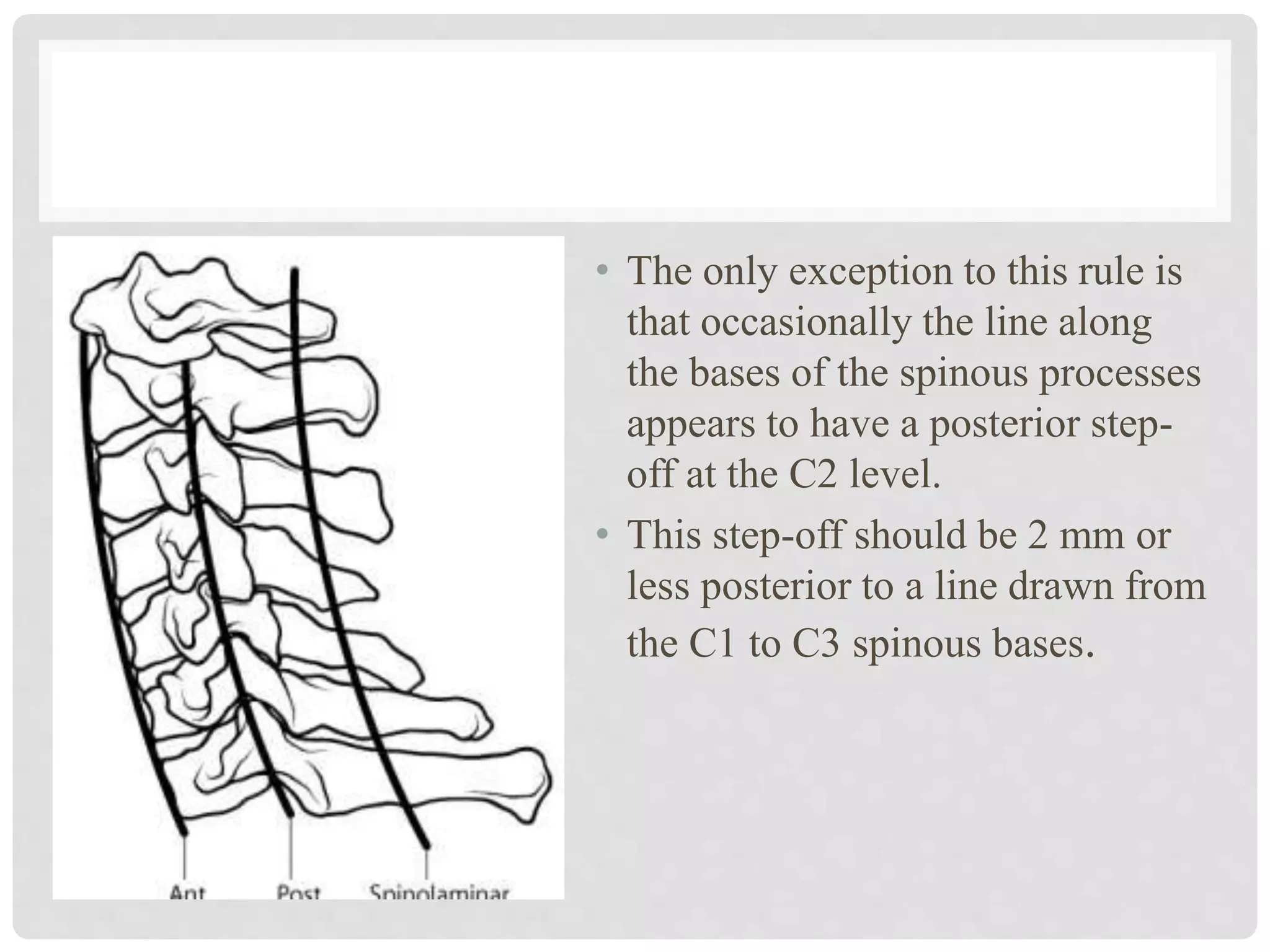 Cervical Spine Radiograph - MaxilloFacial Trauma | PPTX