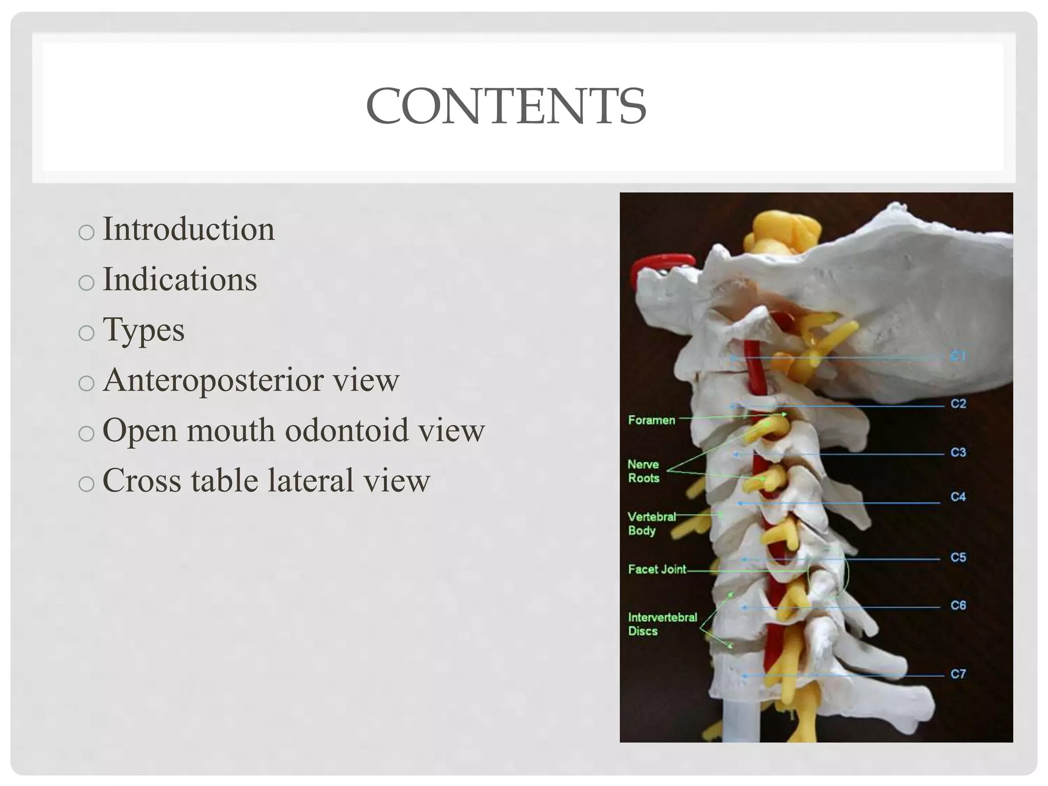 Cervical Spine Radiograph - MaxilloFacial Trauma | PPTX