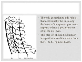 Cervical Spine Radiograph - MaxilloFacial Trauma | PPT