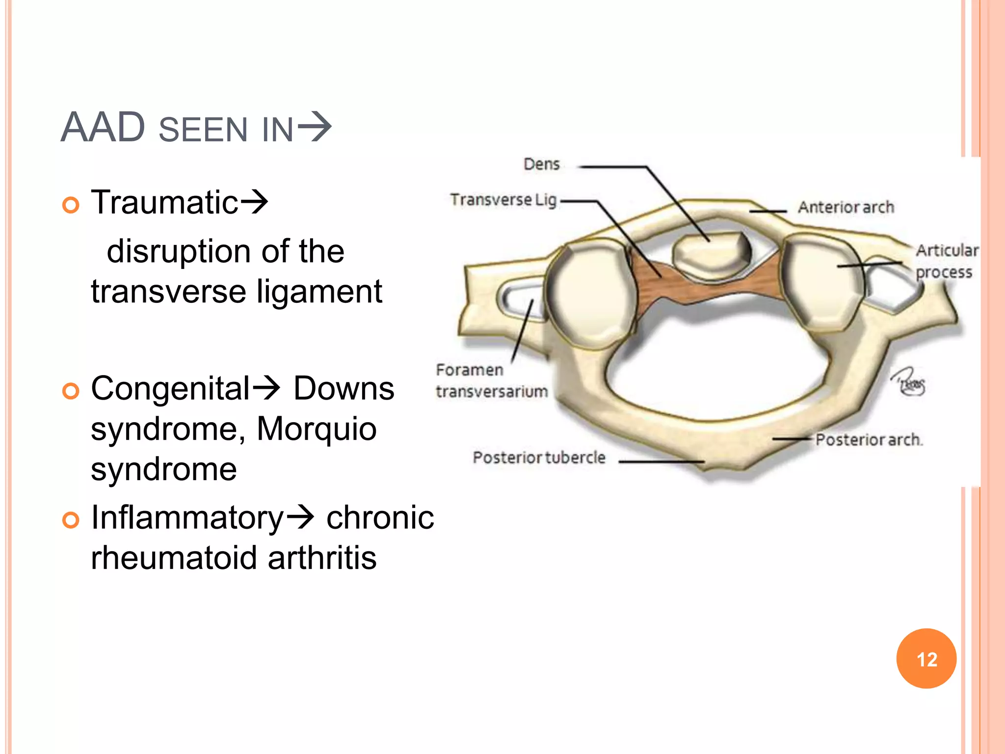 Cervical spine fracture radiology, classification and management | PPTX