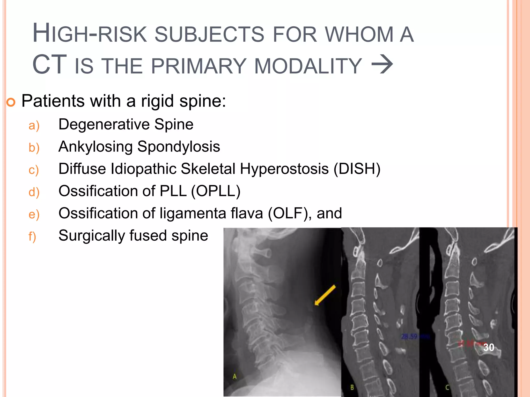 Cervical spine fracture radiology, classification and management | PPTX