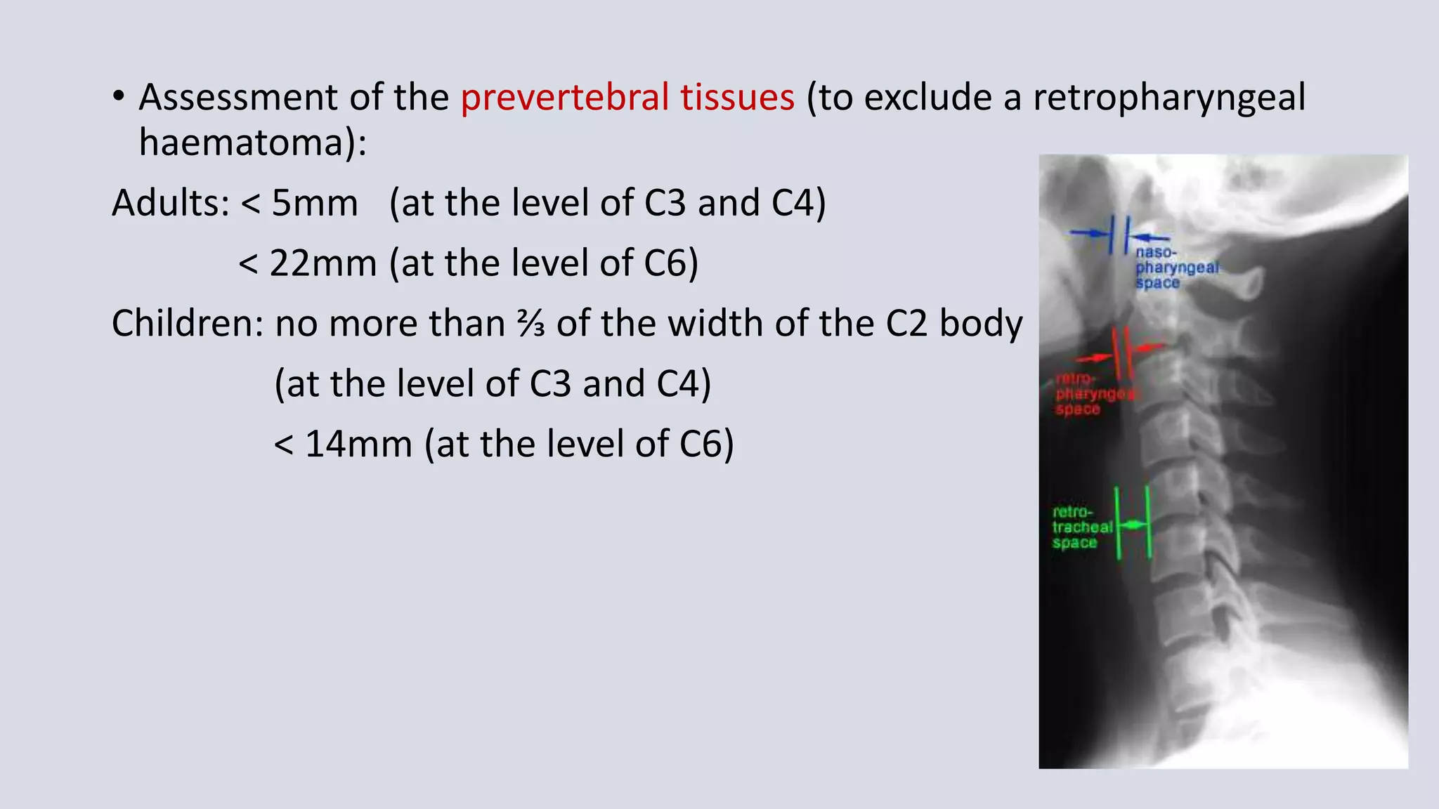 Cervical spine trauma | PPTX