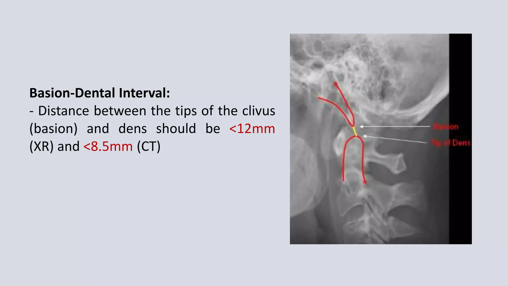 Cervical spine trauma | PPTX