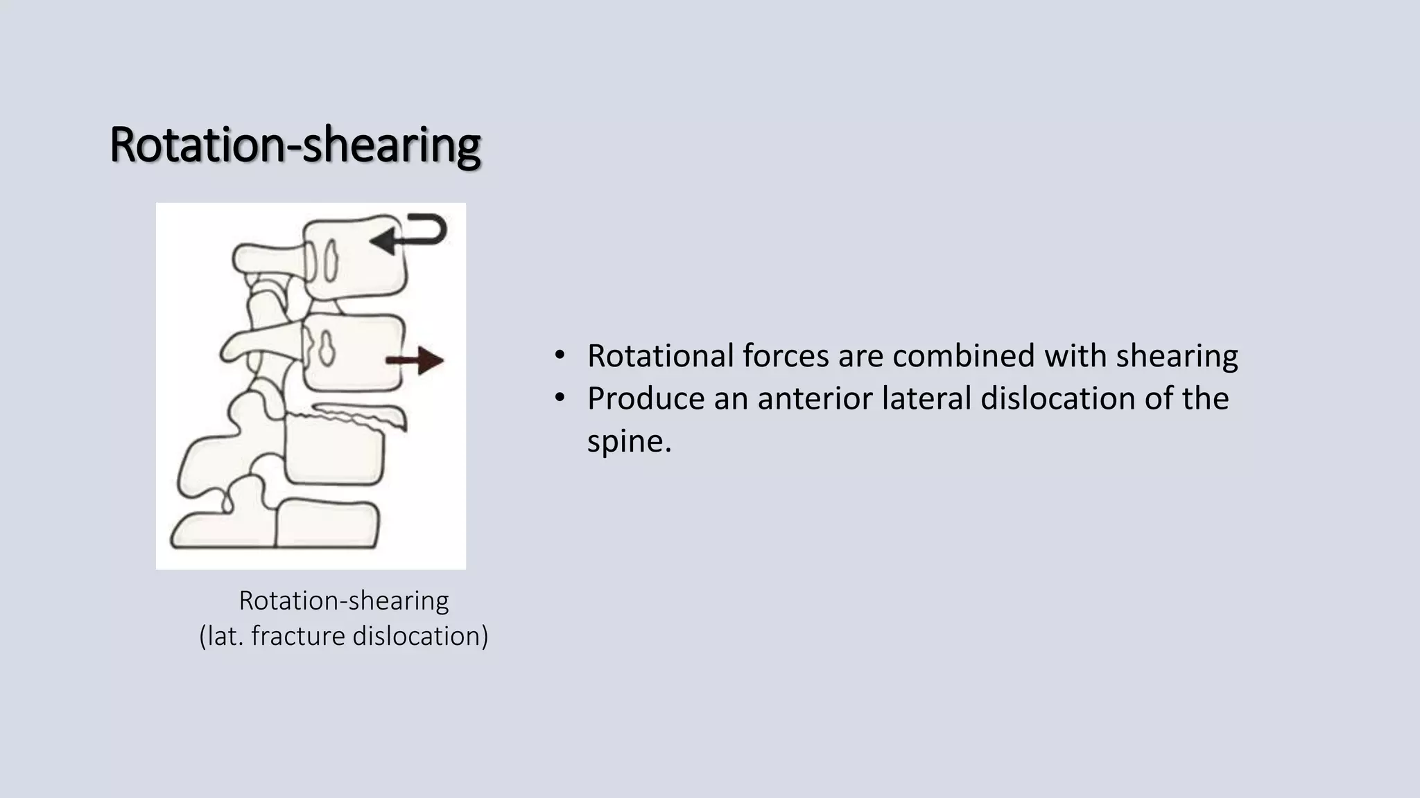 Cervical spine trauma | PPTX