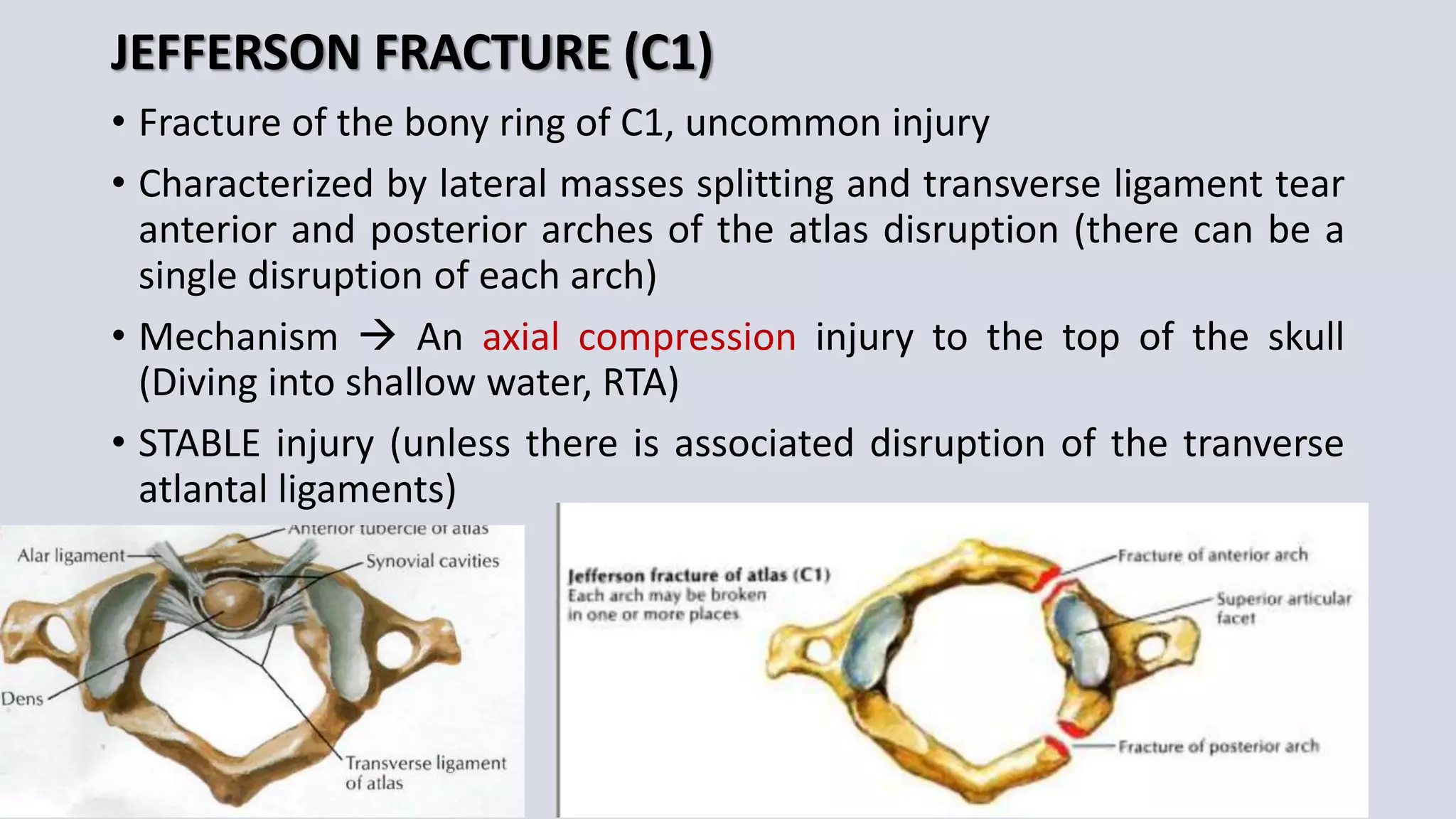 Cervical spine trauma | PPTX