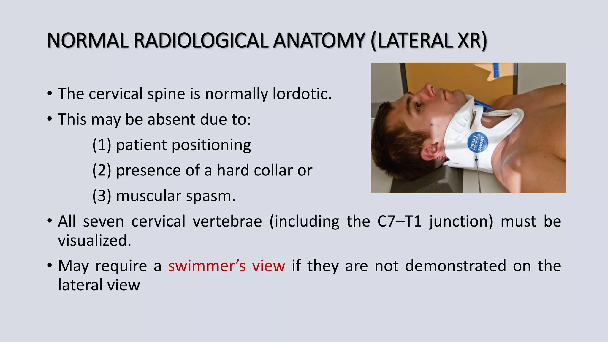 Cervical spine trauma | PPTX