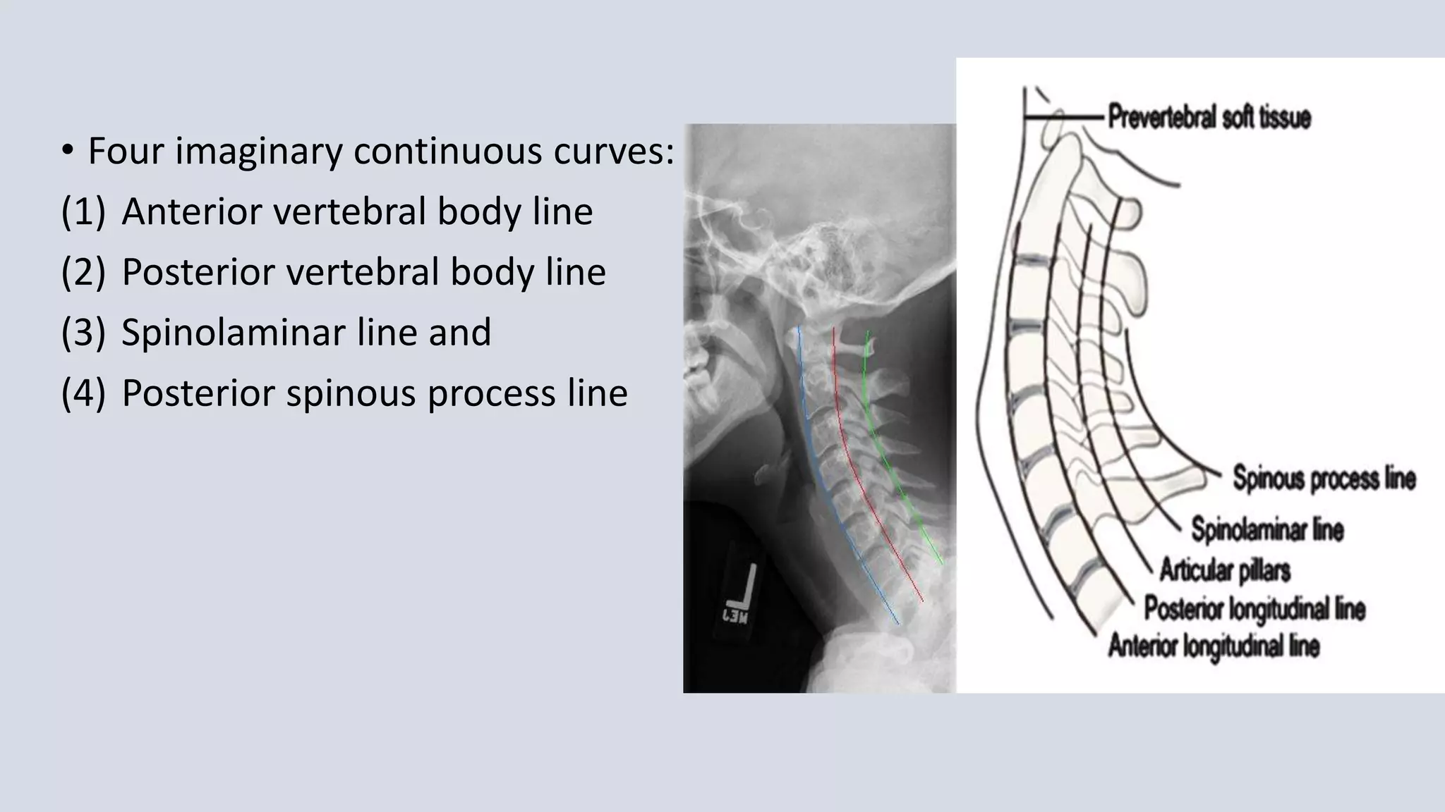 Cervical spine trauma | PPTX
