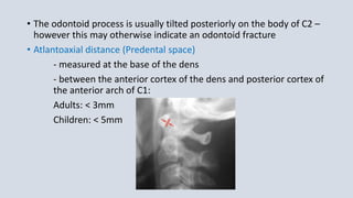 Cervical spine trauma | PPTX