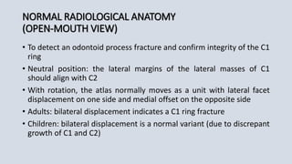 Cervical spine trauma | PPTX