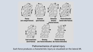 Cervical spine trauma | PPTX