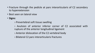 Cervical spine trauma | PPTX
