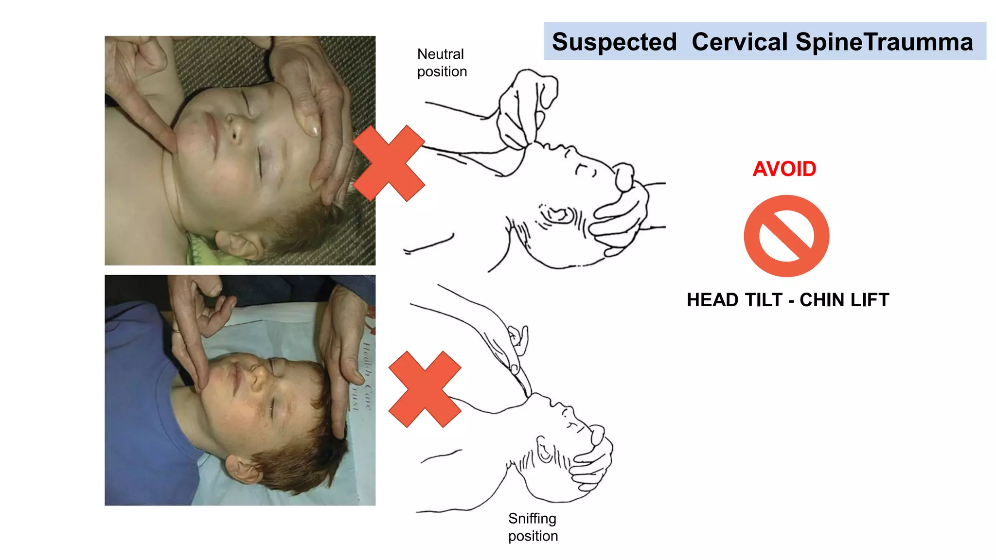 Cervical spine trauma and spinal cord injuries by Dr Shamavu Gabriel.pptx