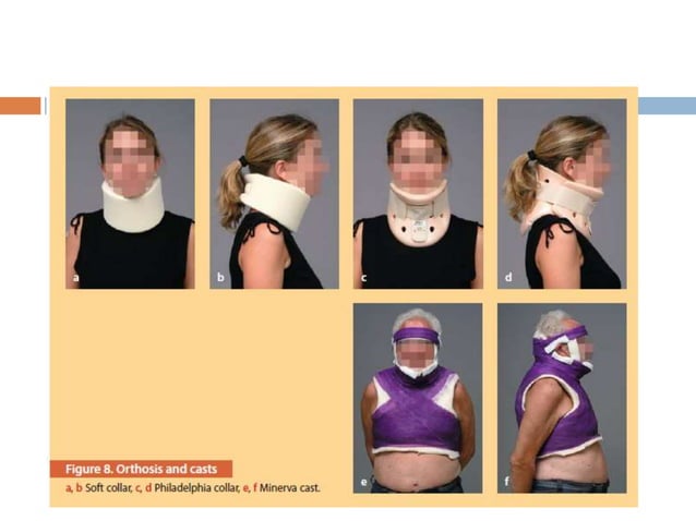 Cervical spine trauma asif.pptx