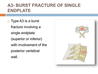 Cervical spine trauma asif.pptx