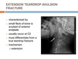 Cervical spine trauma asif.pptx