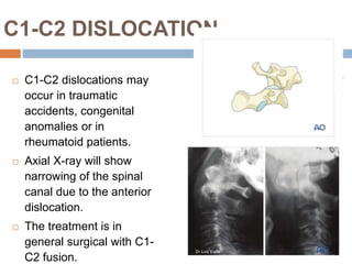 Cervical spine trauma asif.pptx