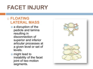 Cervical spine trauma asif.pptx
