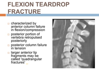 Cervical spine trauma asif.pptx