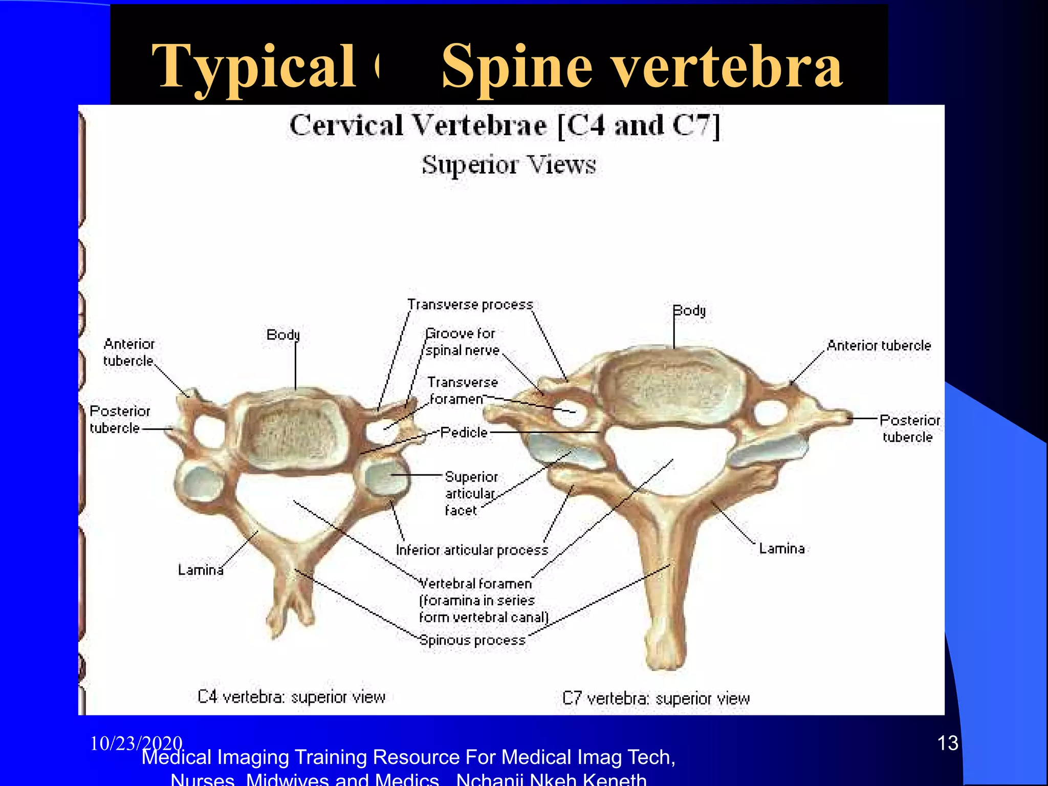 Cervical spine x ray and pathologies radiology training resource ...