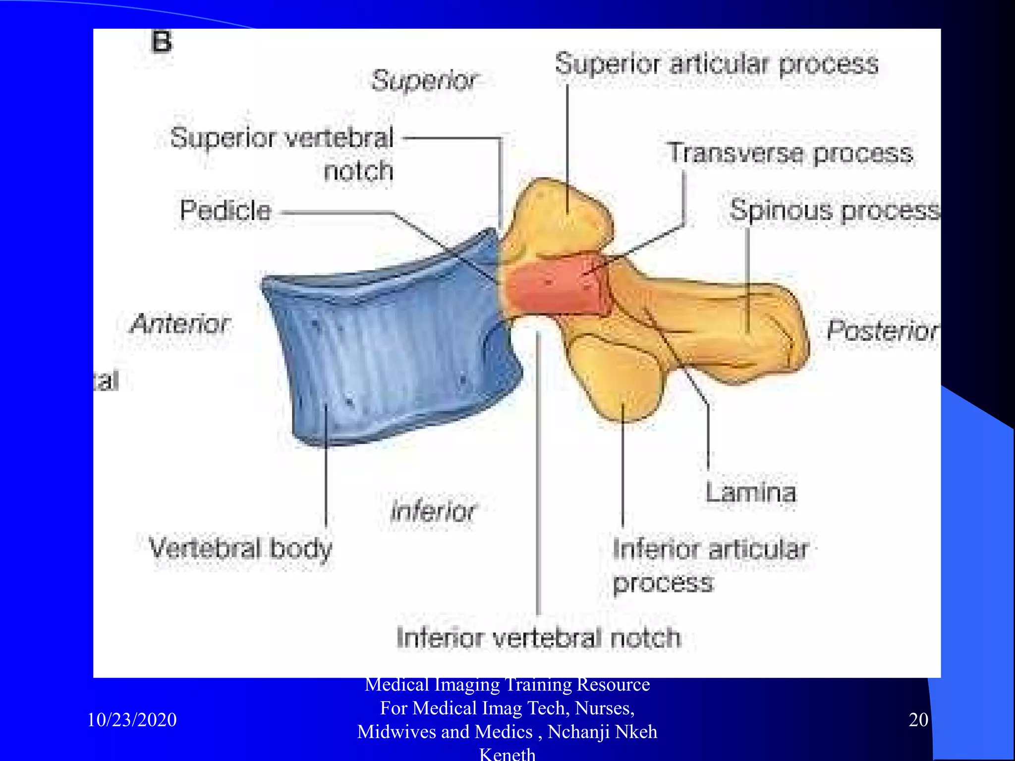 Cervical spine x ray and pathologies radiology training resource ...