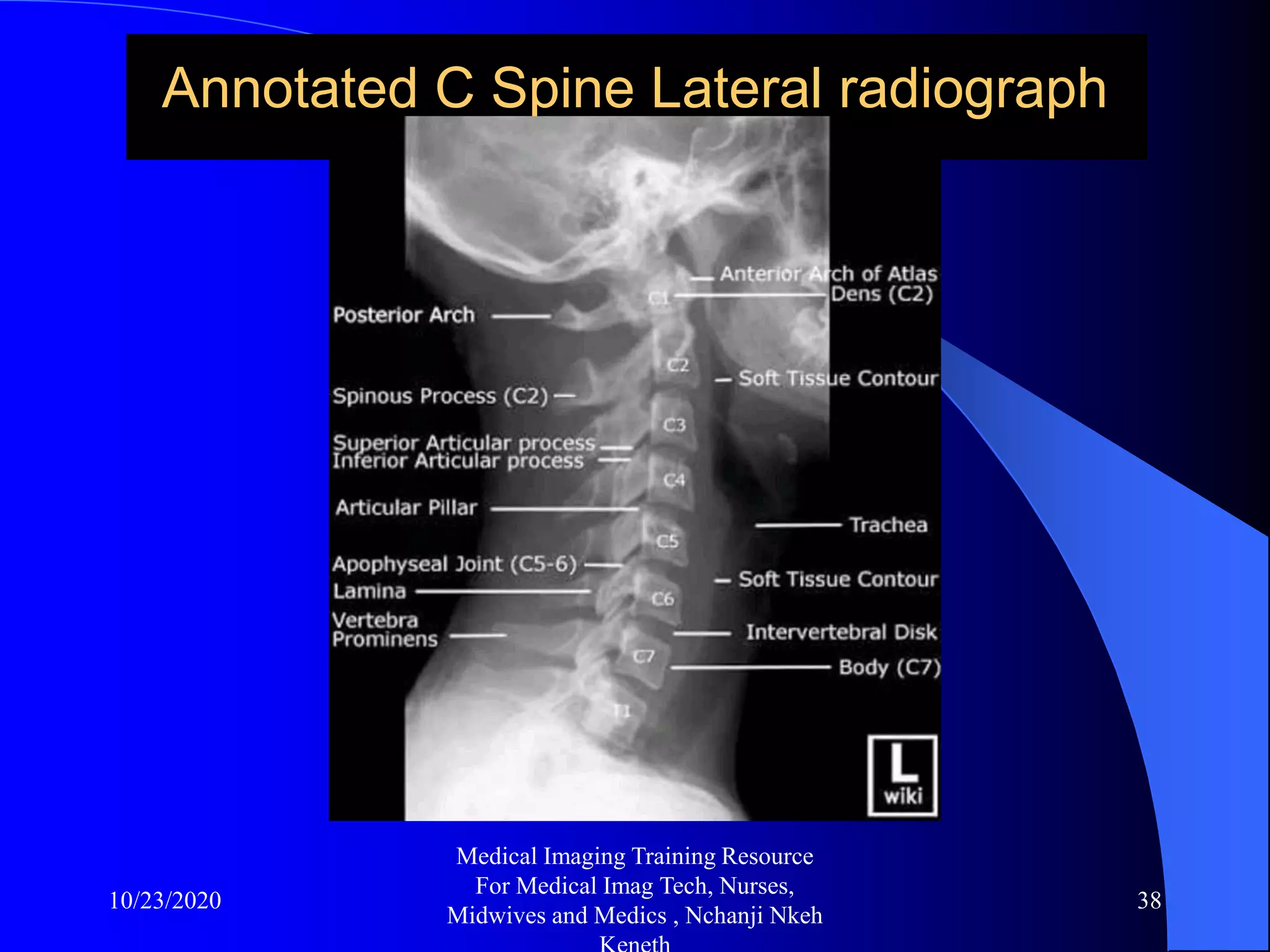 Cervical spine x ray and pathologies radiology training resource ...