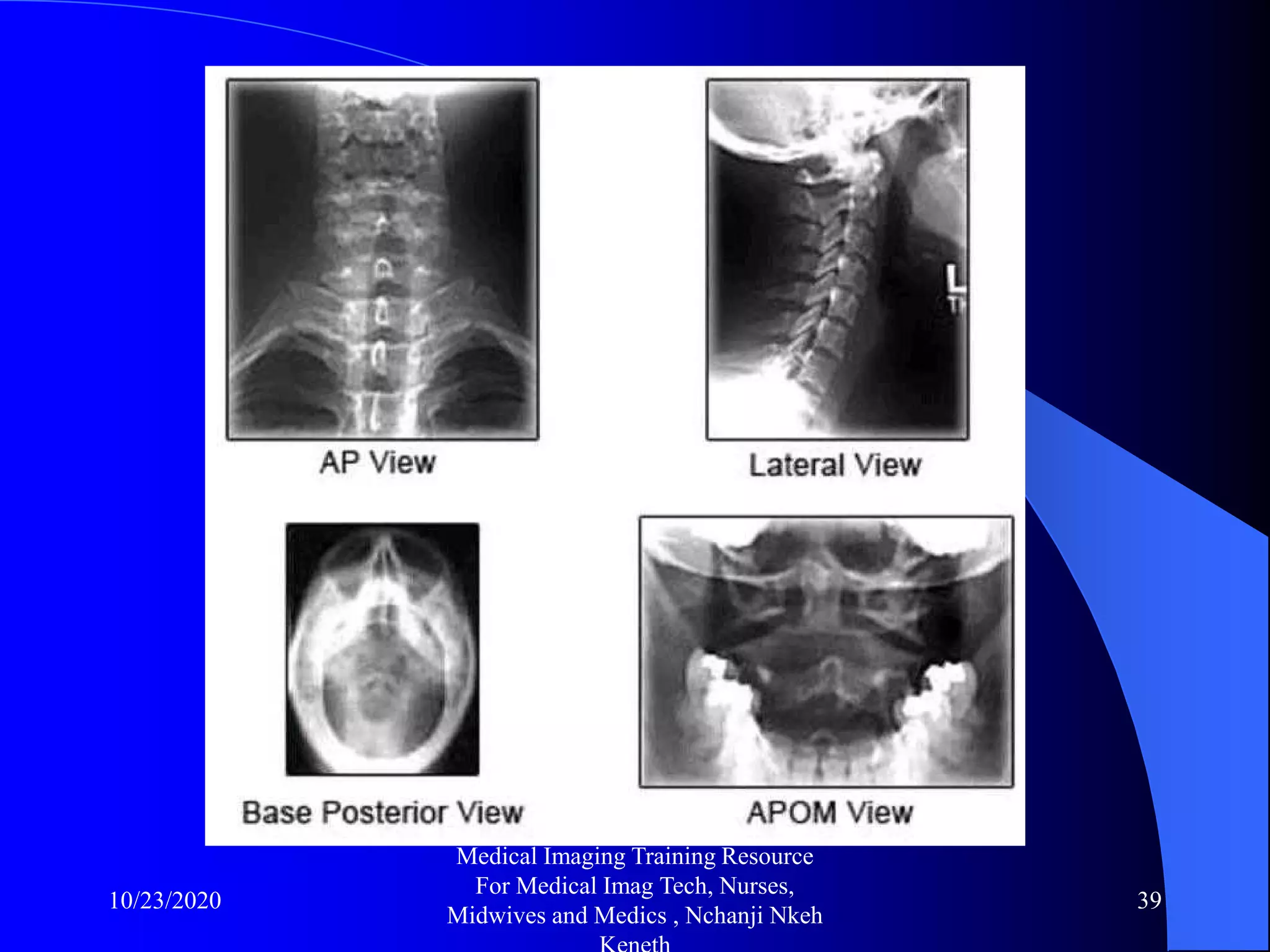 Cervical spine x ray and pathologies radiology training resource ...