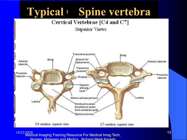 Cervical spine x ray and pathologies radiology training resource ...