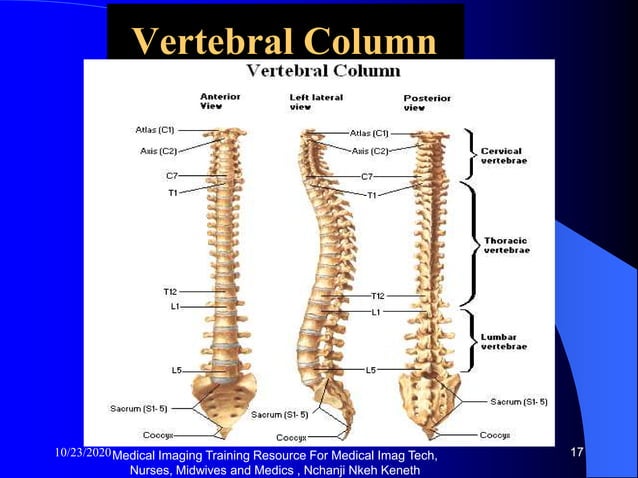 Cervical spine x ray and pathologies radiology training resource ...
