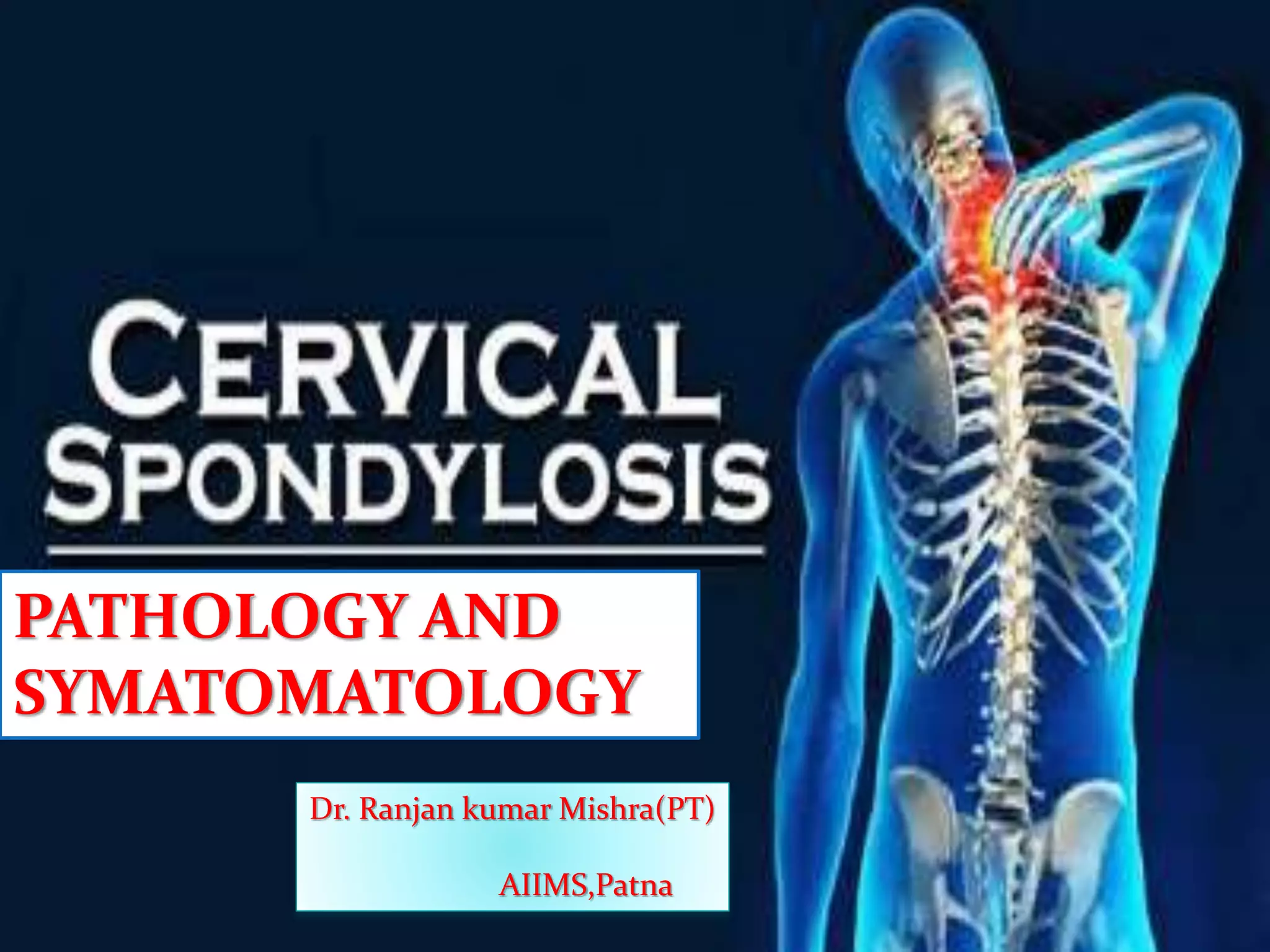 Cervical spondylosis | PPTX