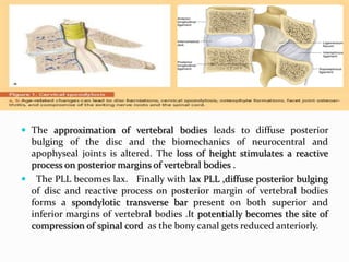 Cervical spondylosis | PPTX