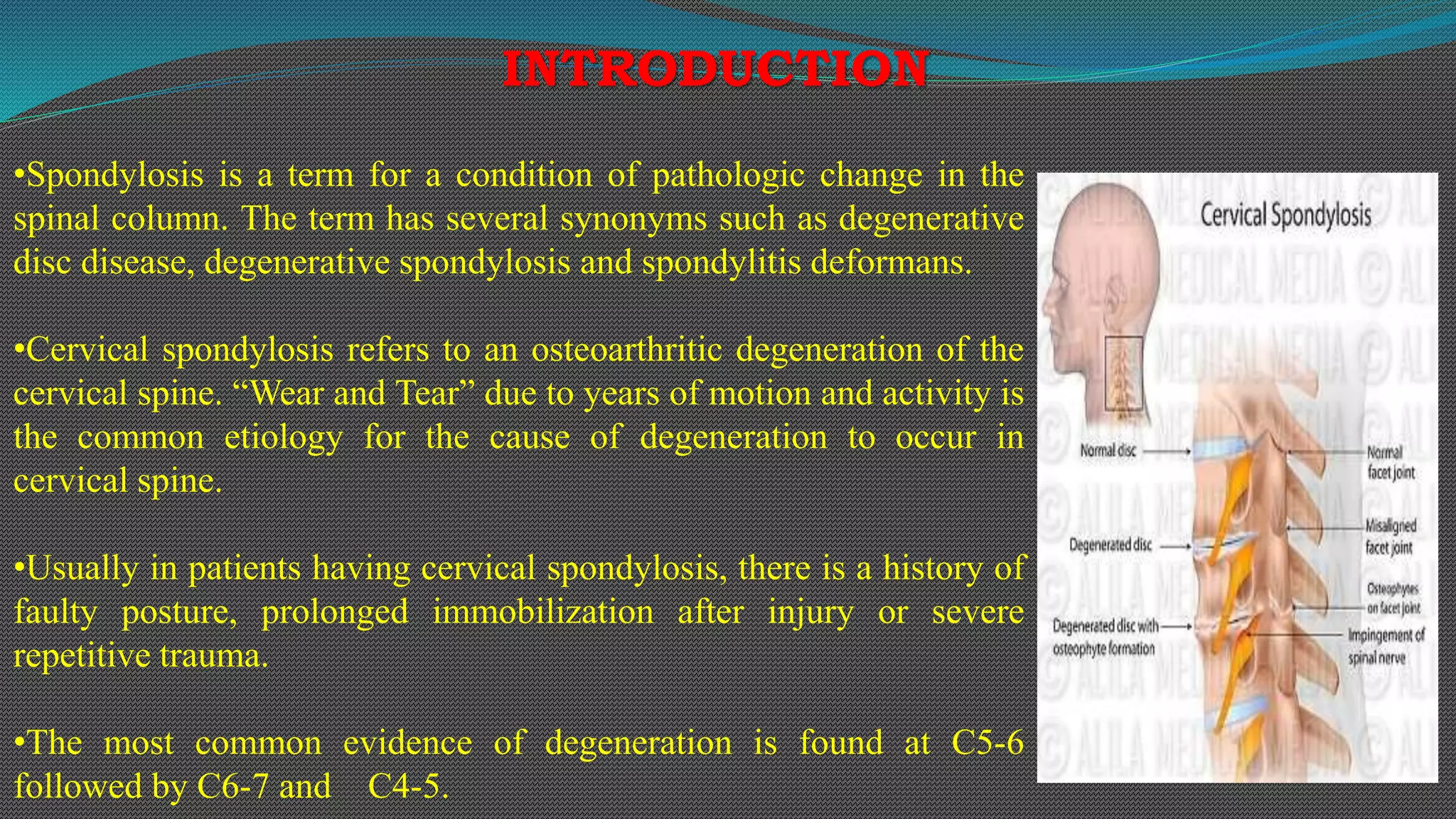 Cervical spondylosis | PPTX | Bone and Joint Conditions | Diseases and ...