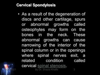 Cervical Spondylosis | PDF
