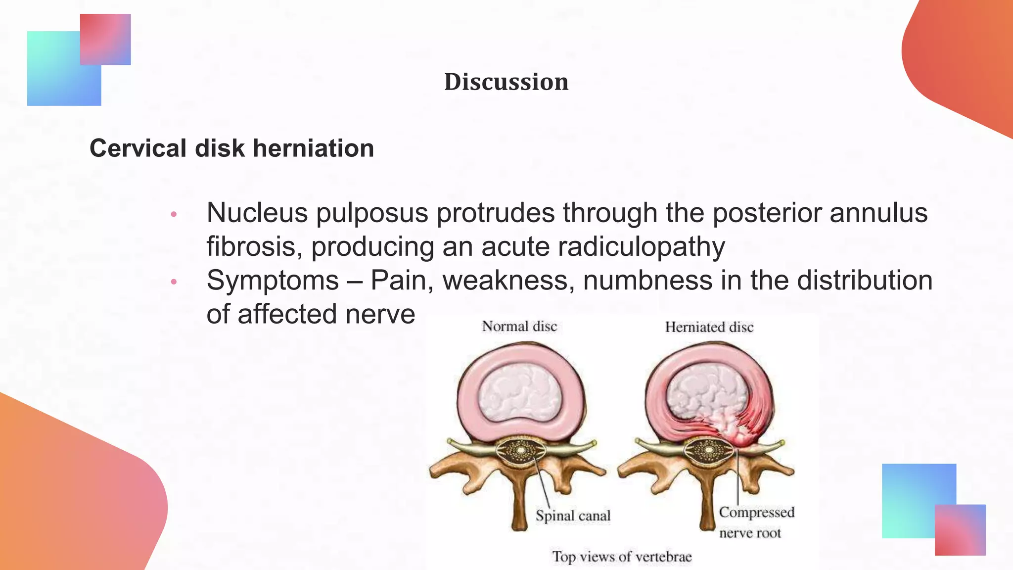 Neck pain case presentation - Cervical spondylosis | PPSX