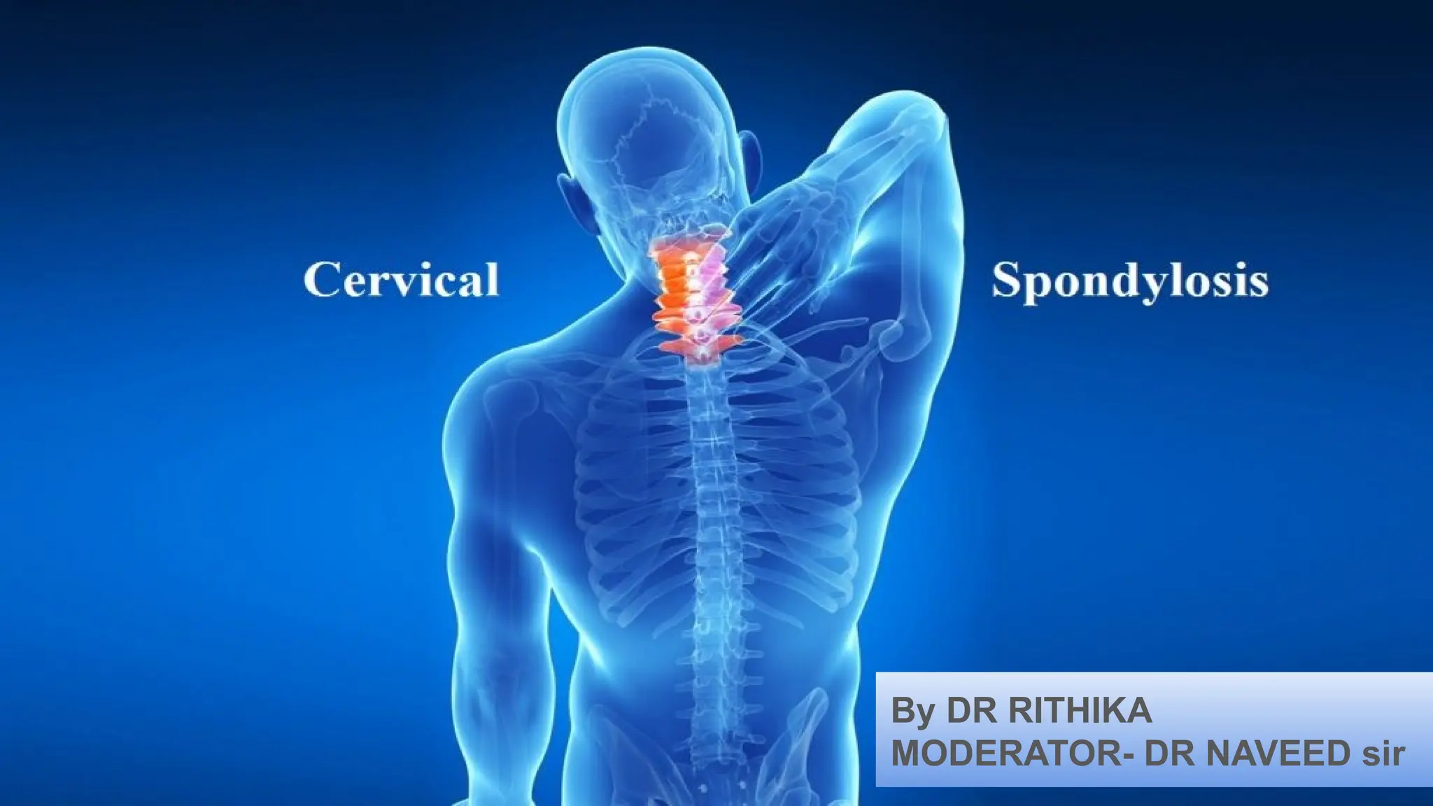 Cervical spondylosis Degenerative cervical spine | PPTX