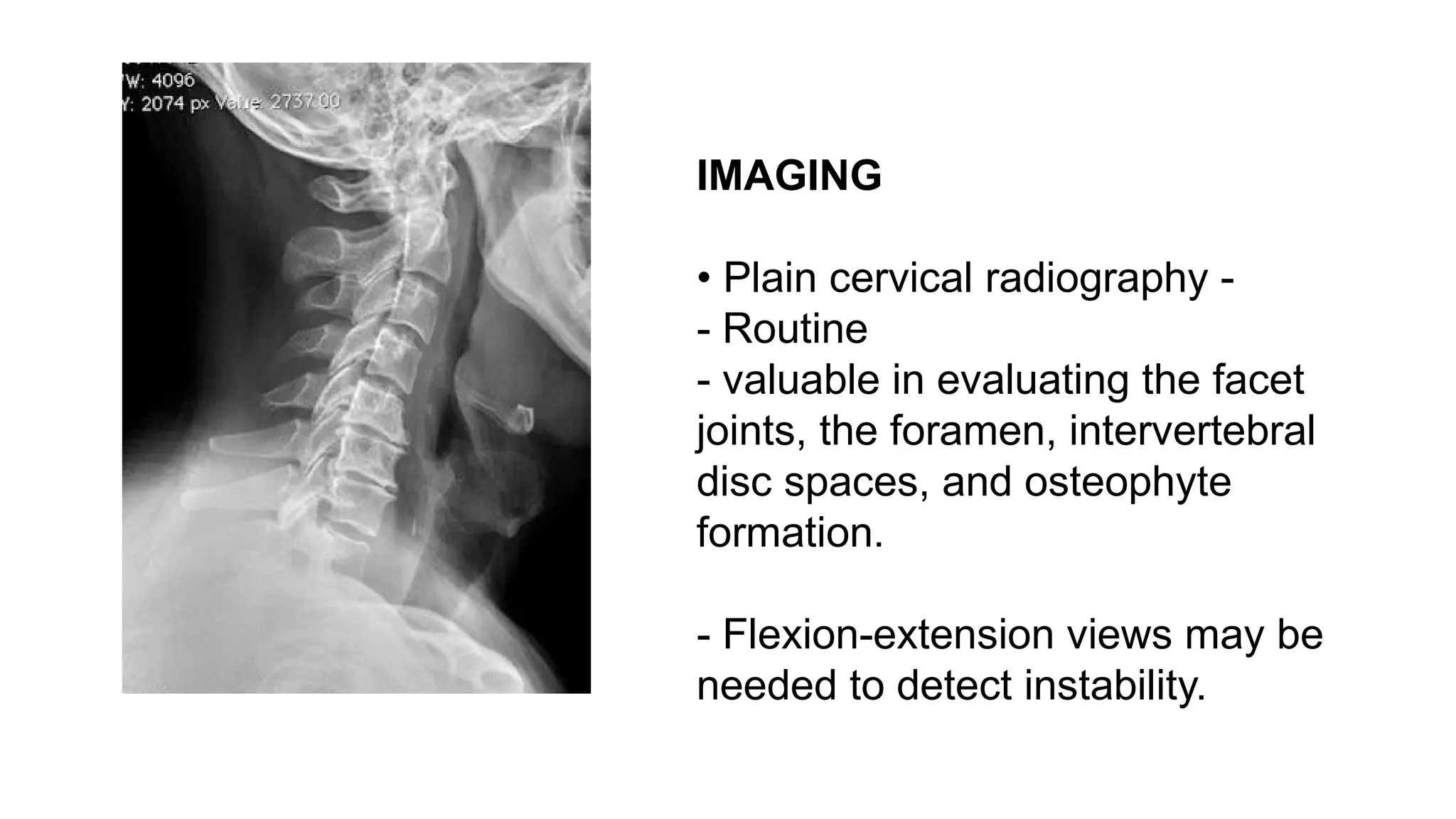 Cervical spondylosis Degenerative cervical spine | PPTX