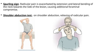 Cervical Spondylosis and associated conditions | PPT