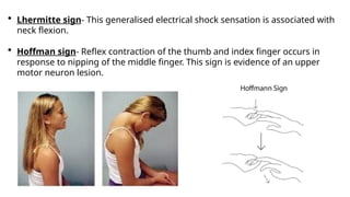 Cervical Spondylosis and associated conditions | PPT