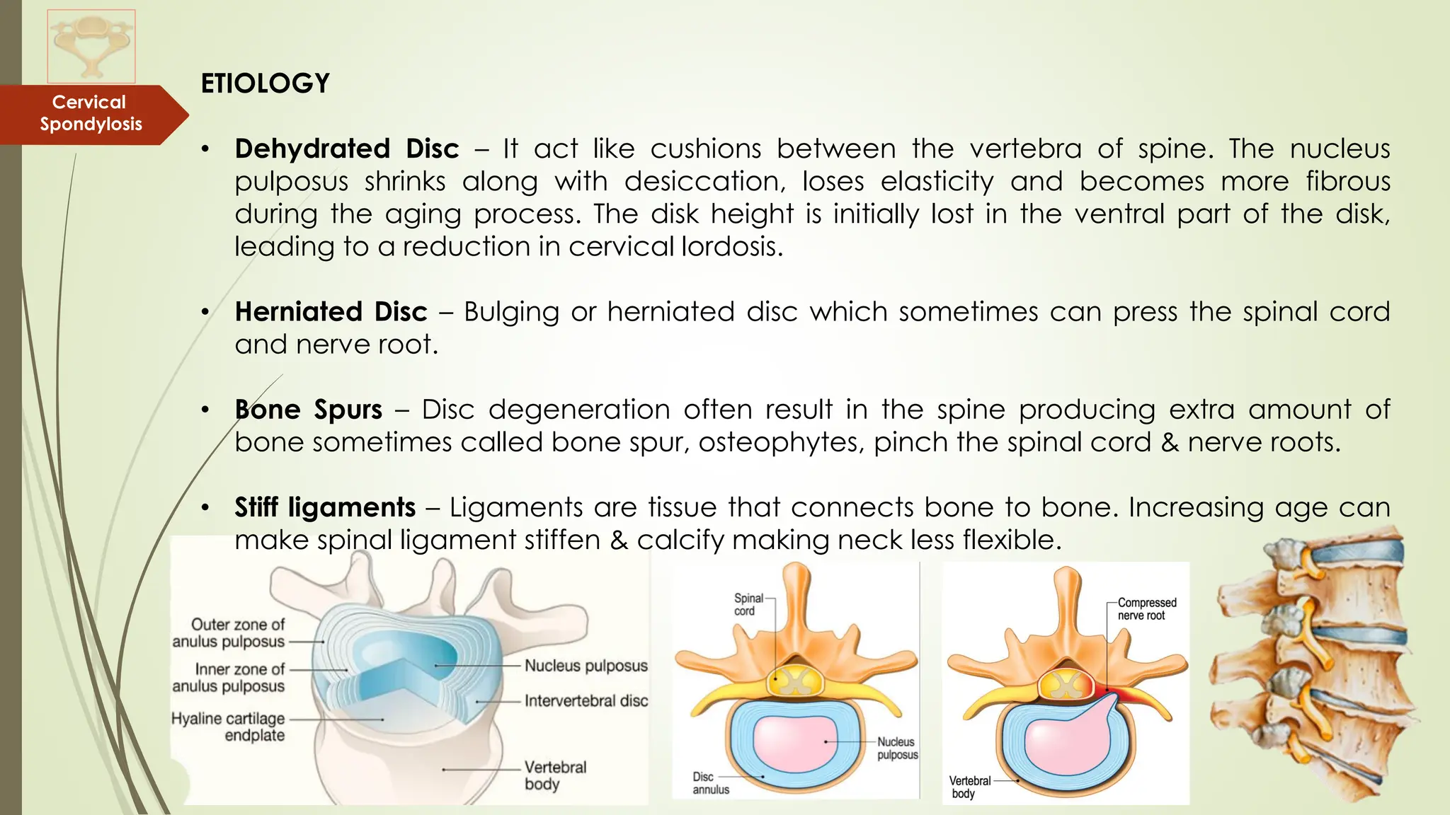 Cervical Spondylosis - An Overview of Degenerative Cervical Spine ...