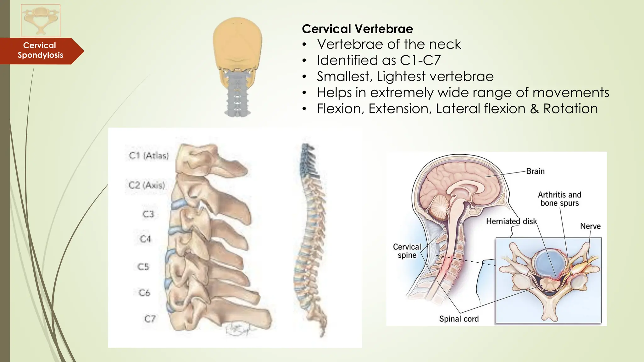 Cervical Spondylosis - An Overview of Degenerative Cervical Spine ...
