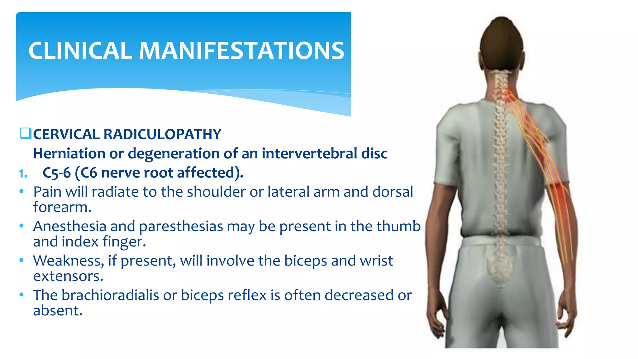 Cervical spondylosis philans cosmos ankrah | PPSX