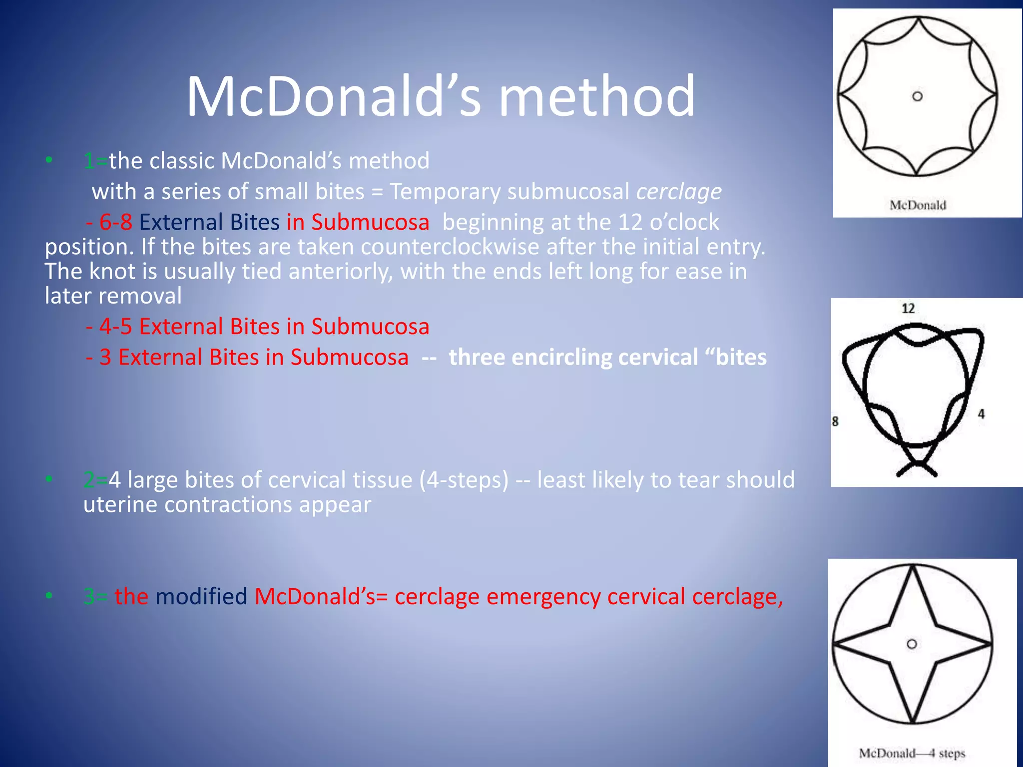 Cervical stitches | PPTX