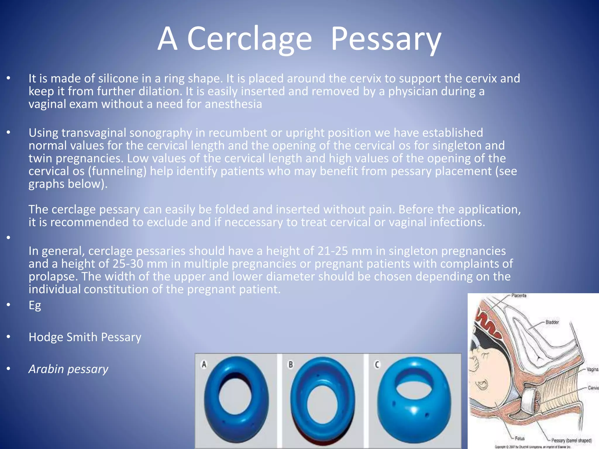 Cervical stitches | PPTX