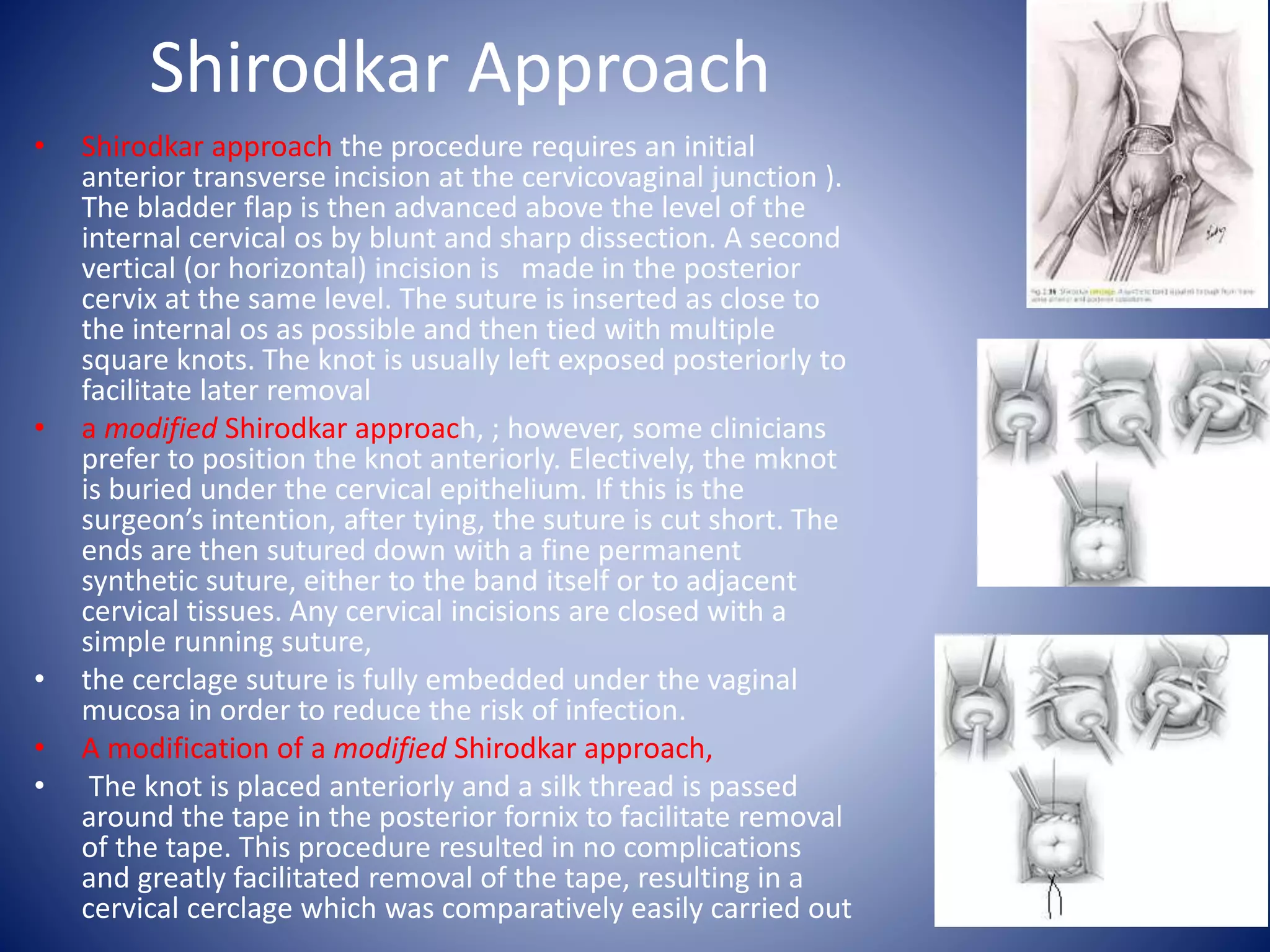 Cervical stitches | PPTX