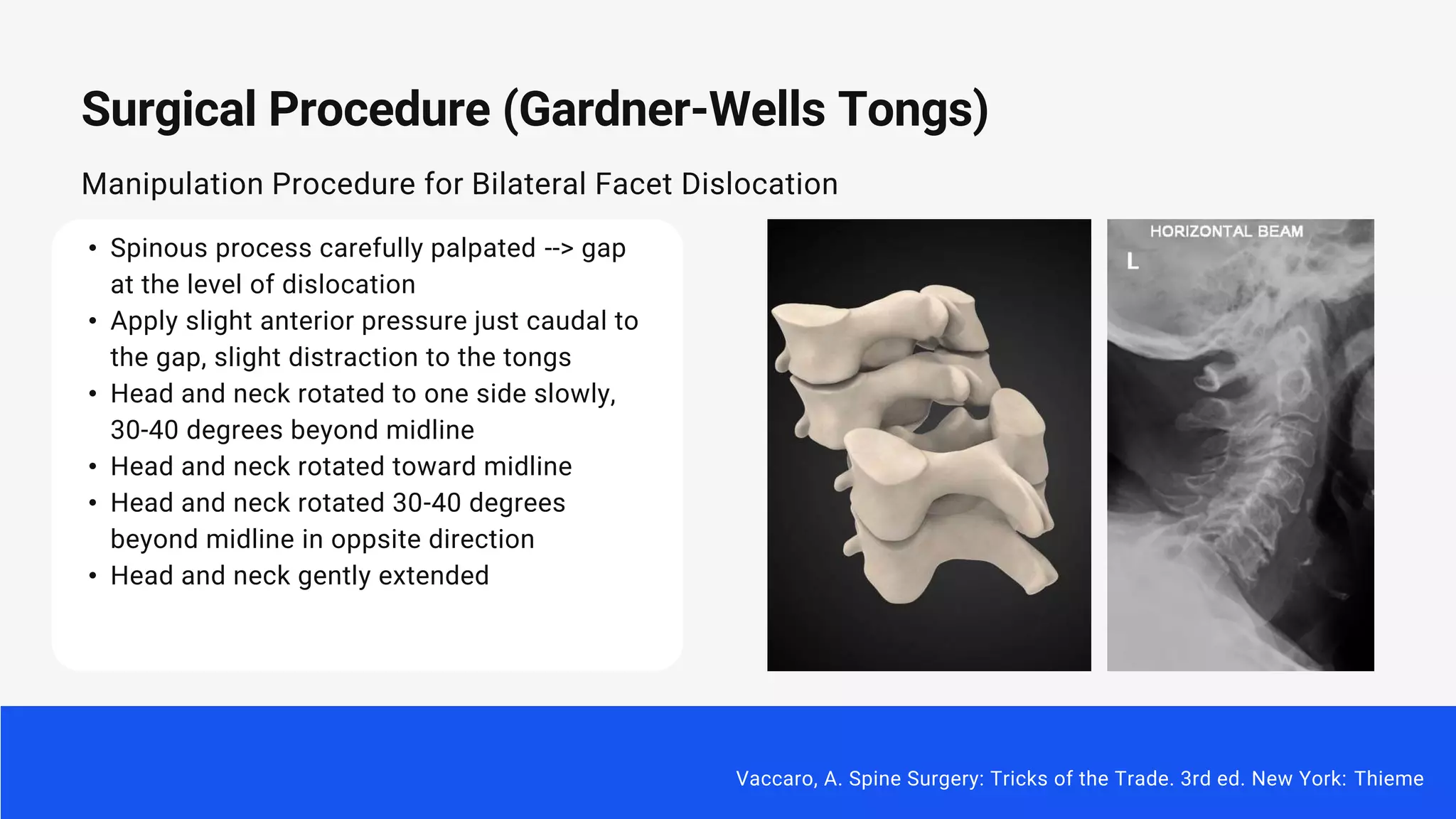 Cervical Traction.pptx