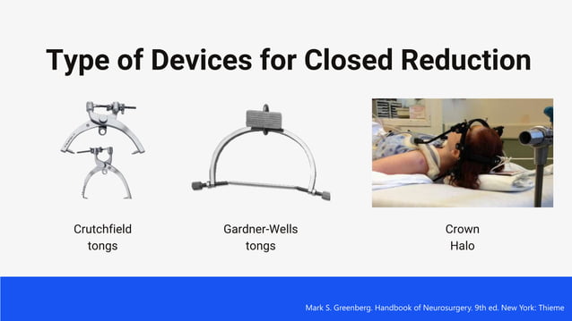 Cervical Traction.pptx
