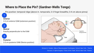 Cervical Traction.pptx